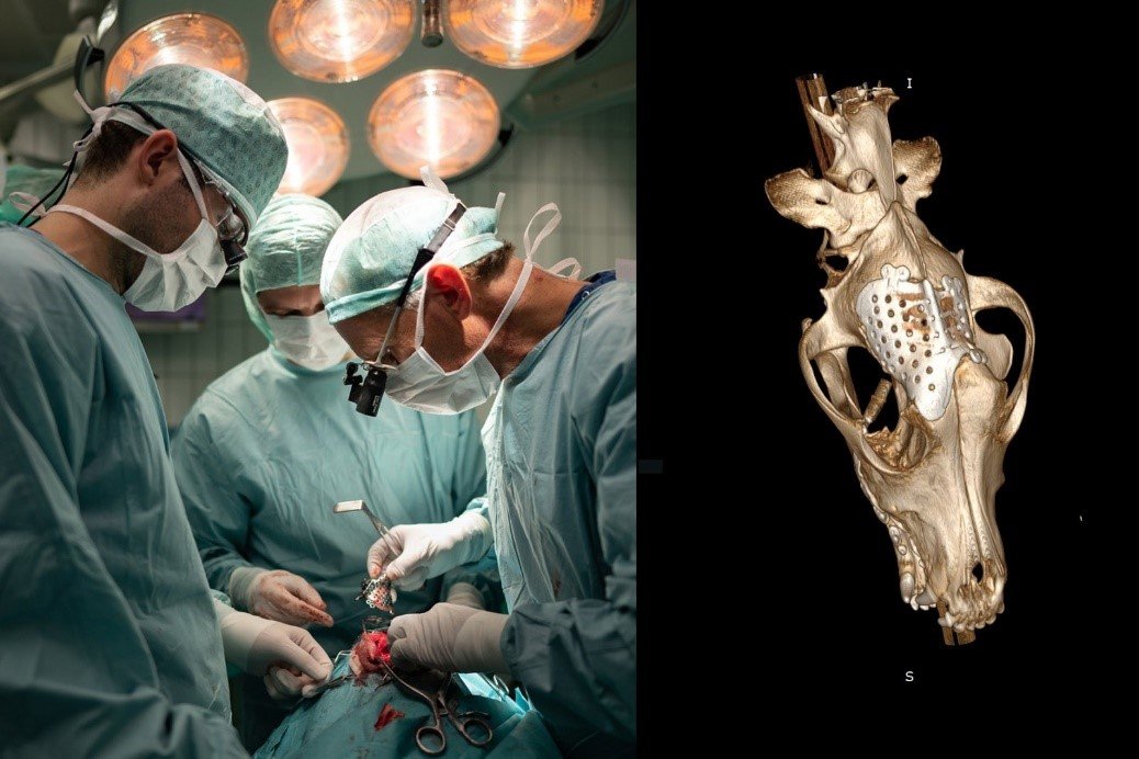 Regenerative Orthopedics | Personalized orthopedic implants
